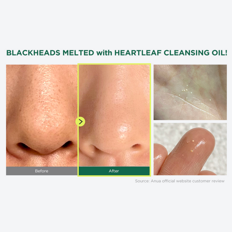 ANUA Heartleaf Pore Control Cleansing Oil 200ml Skin Cupid